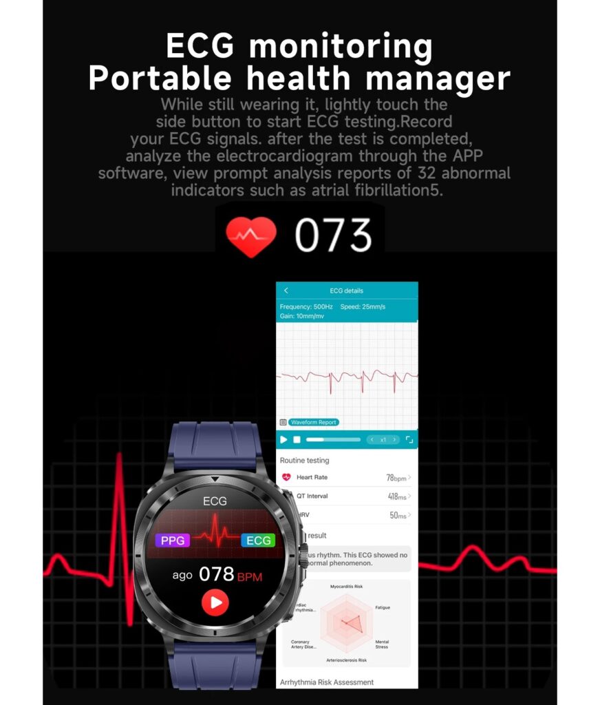 Smartwatch SPOVAN ET492 Electrocardiograma Monitor de Salud - NUBOFIT